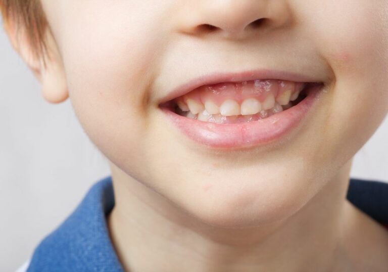 Can My 5 Year Old Be Getting Teeth? Understanding the Tooth Development ...