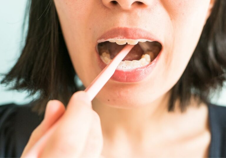Why is my mouth bleeding when I brush my teeth? (Causes & Solutions)