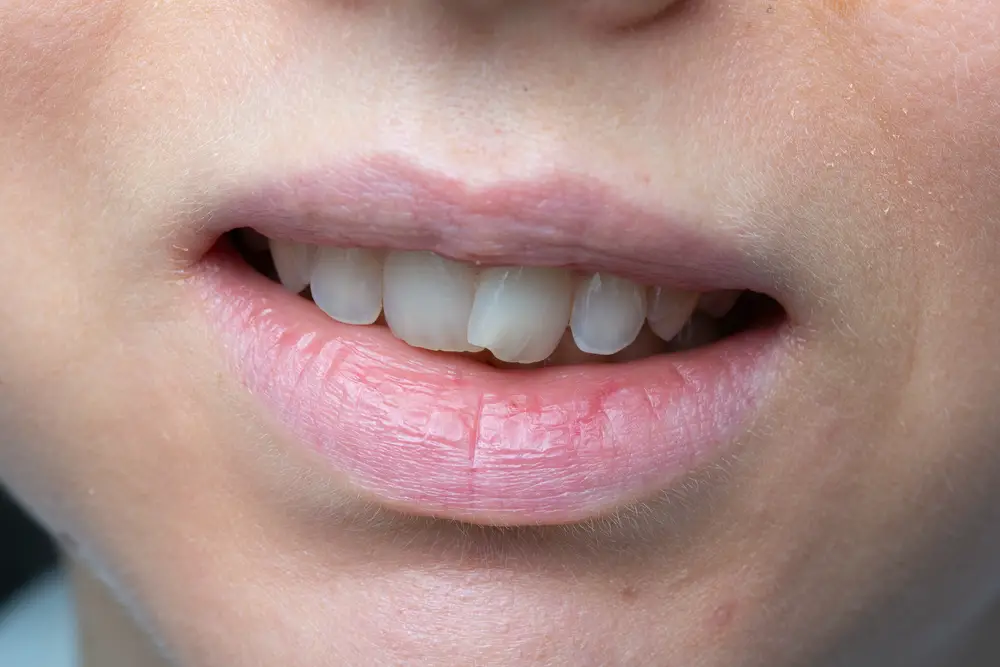 Why Are My Teeth So Slimy? (Causes, Home Remedies)