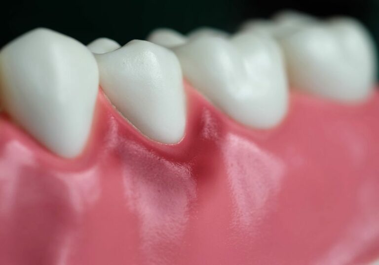 Why Is My Gum Overlapping My Tooth? (A Comprehensive Guide)