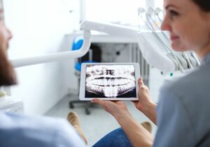 Does Tooth 5 Have 2 Roots? A Quick Guide to Understanding Your Tooth ...