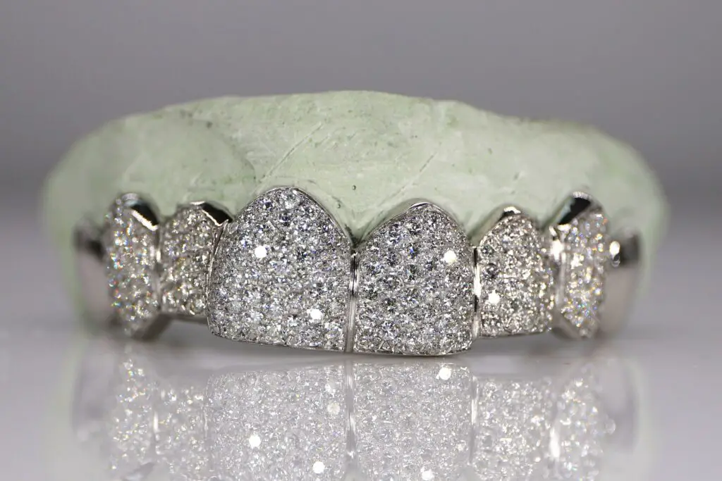 What Are VVS Teeth? A Quick Guide to Understanding This Popular Dental ...