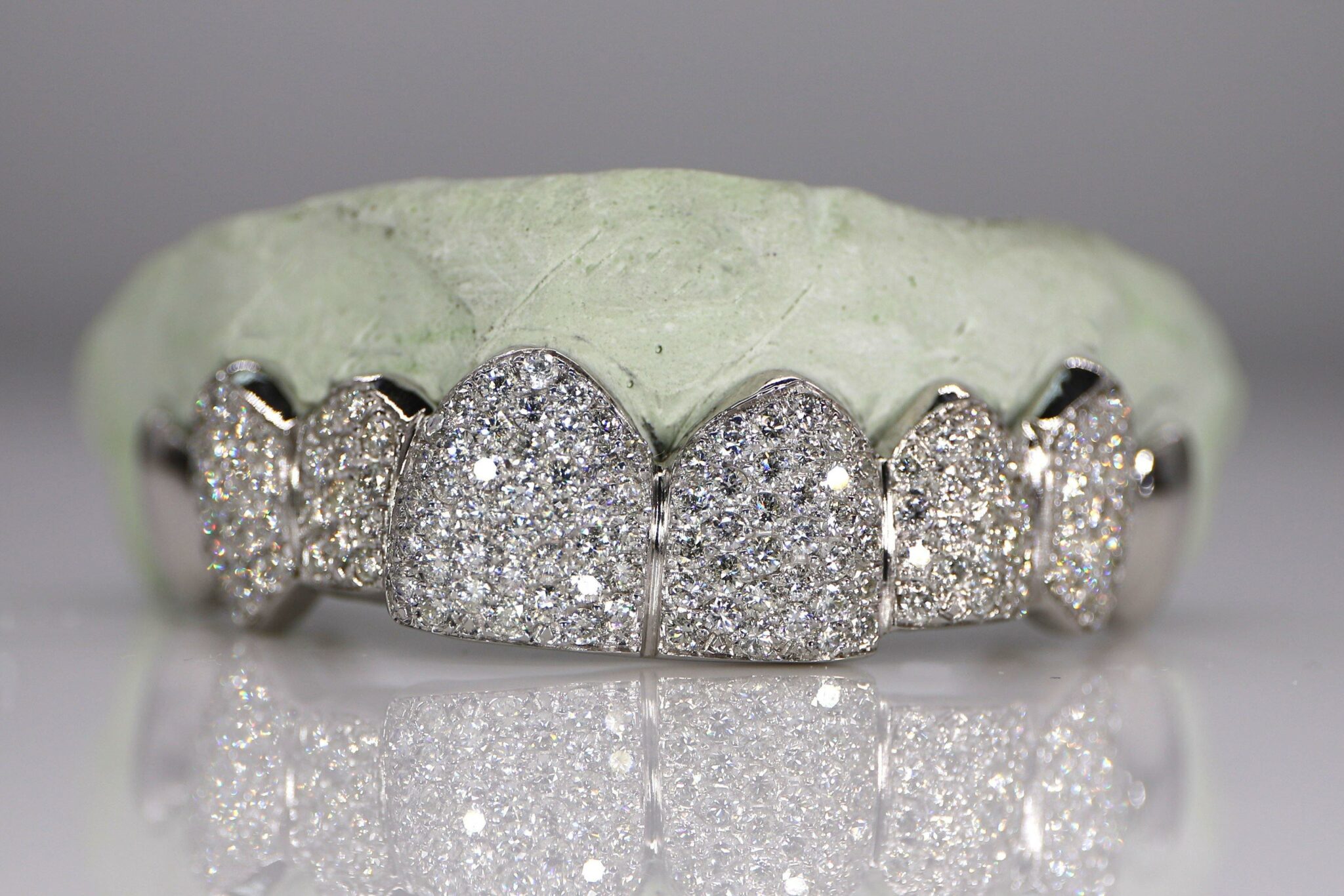 What Are VVS Teeth? A Quick Guide to Understanding This Popular Dental ...