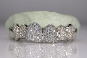 What Are VVS Teeth? A Quick Guide to Understanding This Popular Dental ...