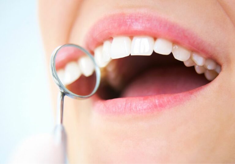 What are Adjacent Teeth? A Quick Guide to Understanding Your Teeth ...