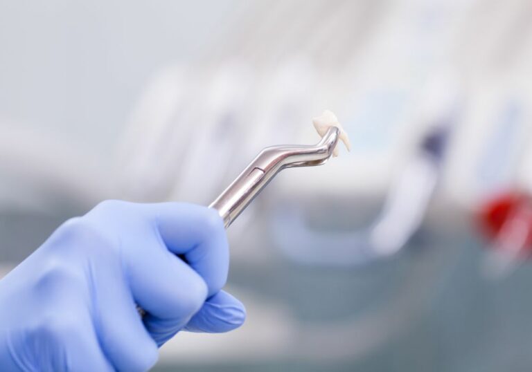When Did Wisdom Teeth Get Their Name? A Brief History