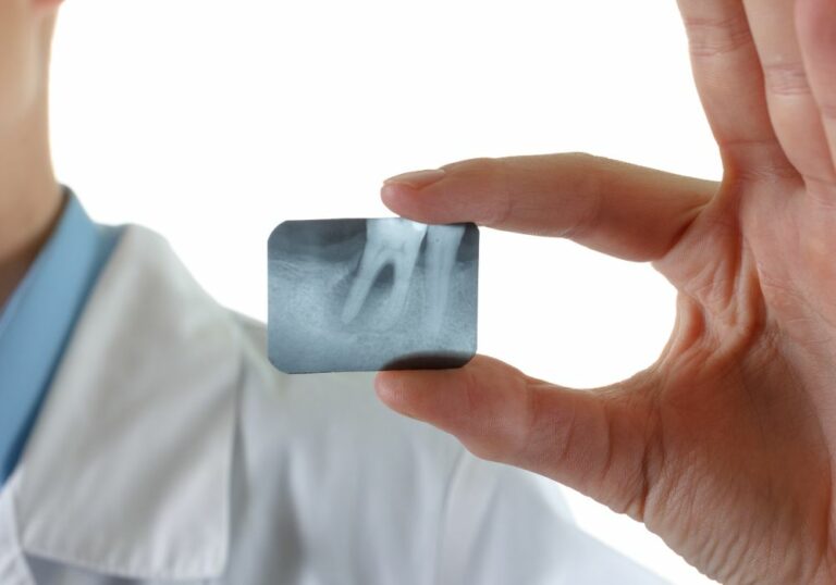 How Deep Does a Tooth Go? Exploring Tooth Anatomy