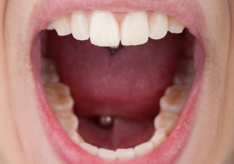 Which Tooth is Number 3? A Quick Guide to Dental Anatomy