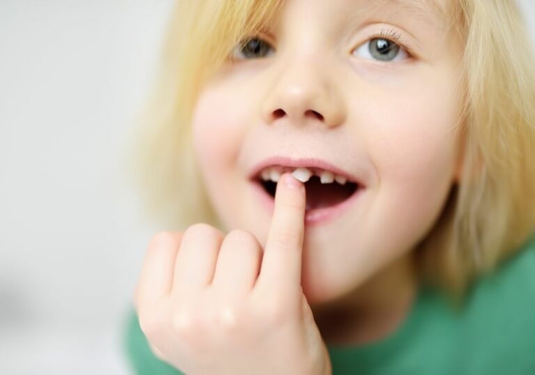 How Many Is a Baby Tooth? Your Guide to Understanding Your Child's ...