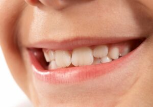 What Affects Teeth Shape? Understanding the Factors that Influence Your ...