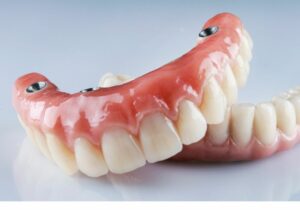 Where is Your #2 Tooth? Find Out Now!