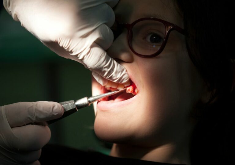 What Can I Use to Numb My Tooth for Extraction?