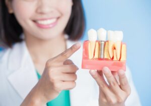 Does a Tooth Need Blood? Exploring the Role of Blood Supply in Tooth Health