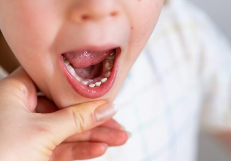 Do molars have baby teeth? Exploring tooth development in children