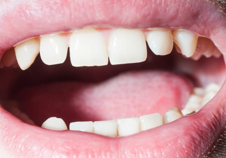 Which Tooth is Number 3? A Quick Guide to Dental Anatomy