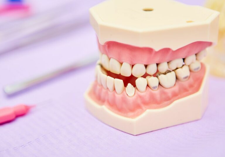How Should Teeth Look When Biting Down? A Guide to Proper Teeth Alignment