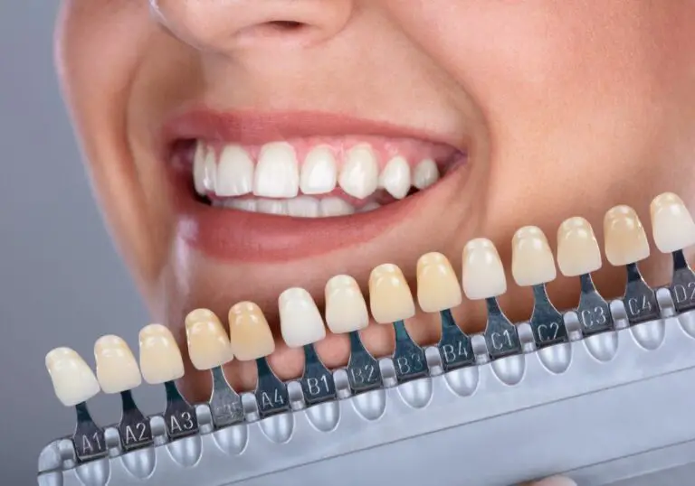 Which Teeth Shade is Best? A Guide to Choosing the Right Shade for Your ...